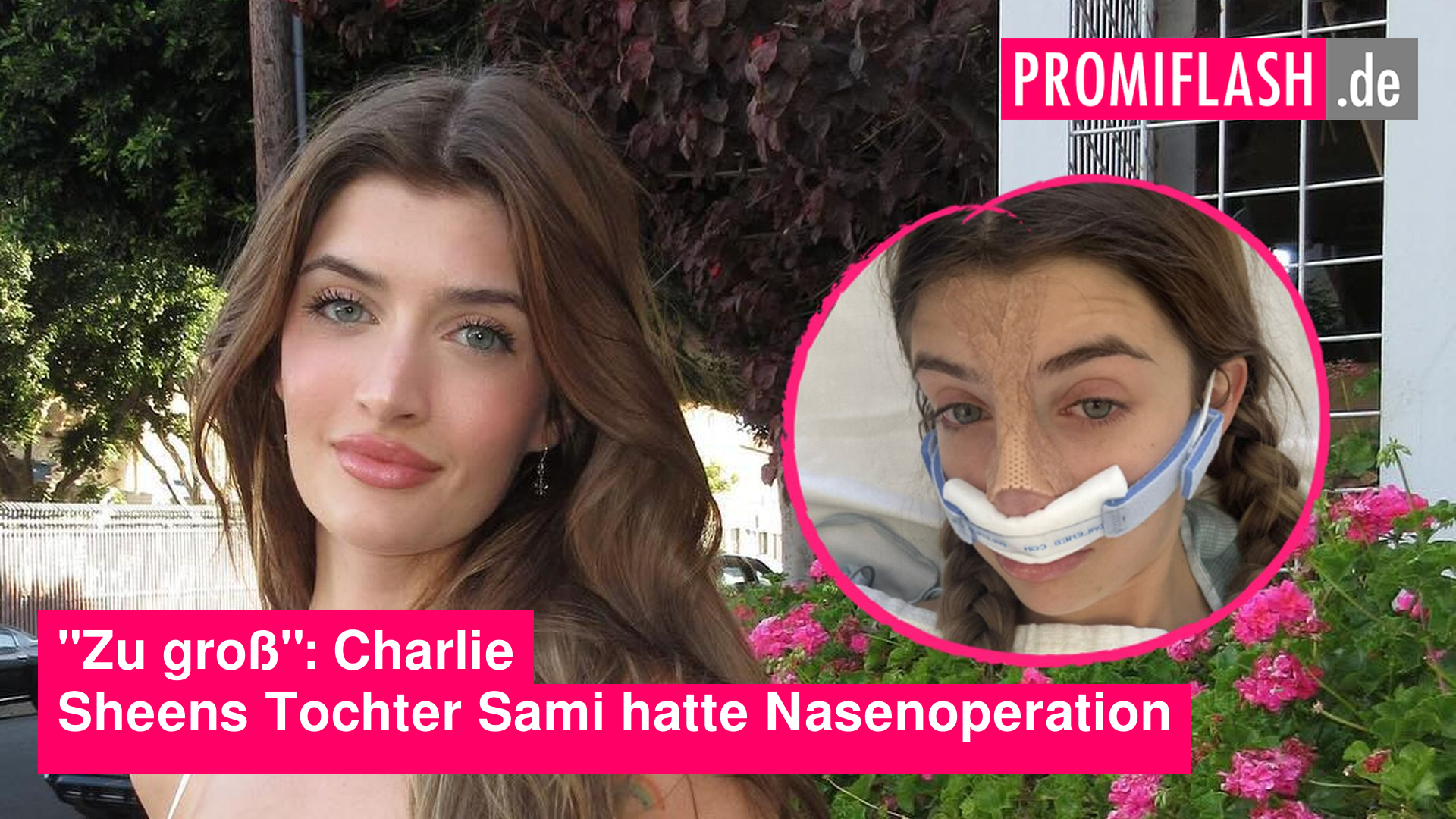 Charlie Sheen Gross Teeth